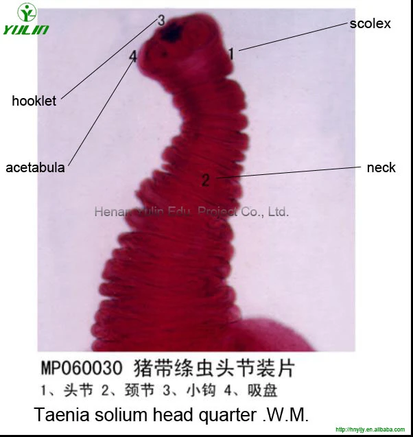Taenia Scolex