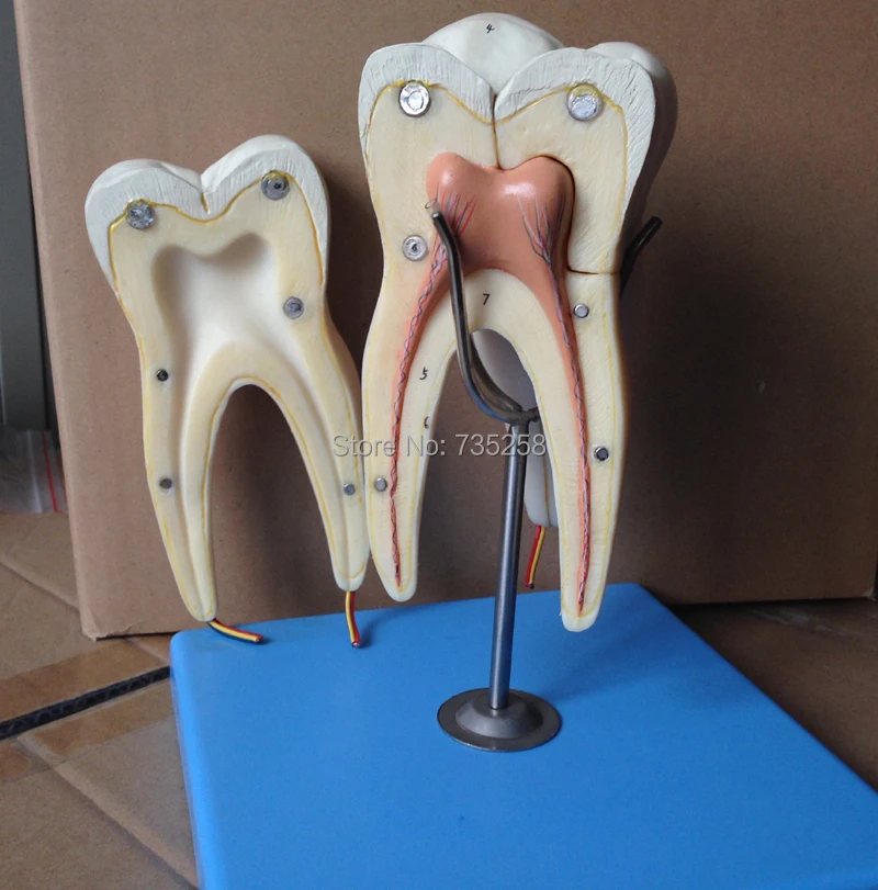 Three Model Of Mandibular Molar Root,teeth Model,molar Model,mandibular ...