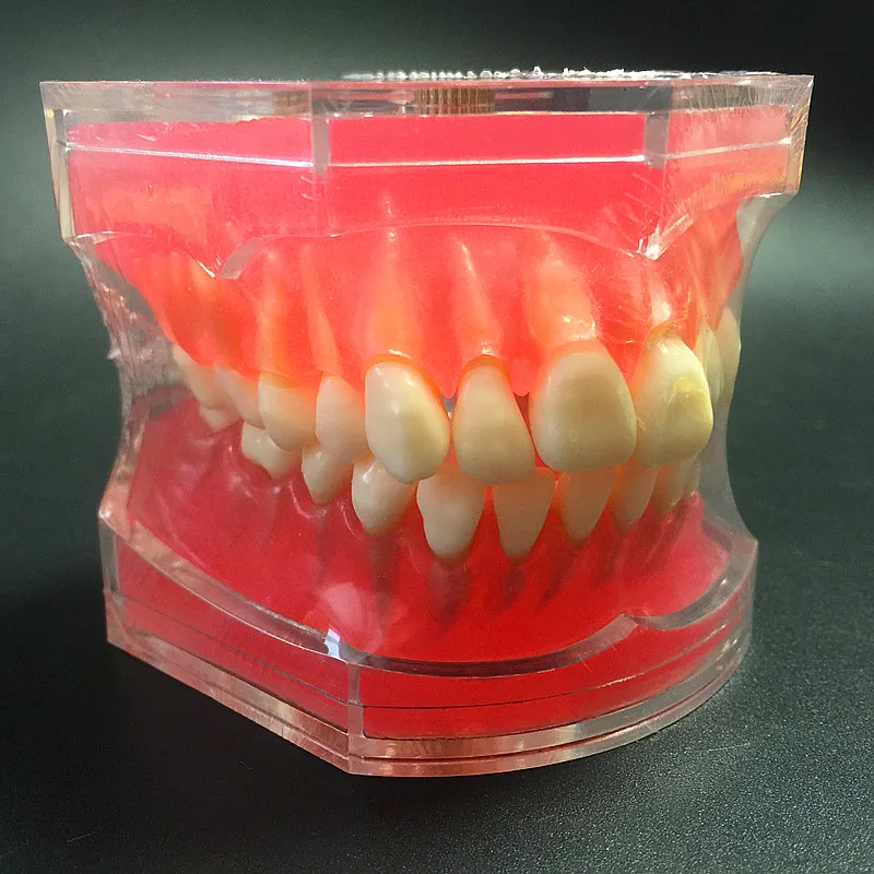 Dental Study Teaching Model Standard Model Removable Teeth Soft Gum ...