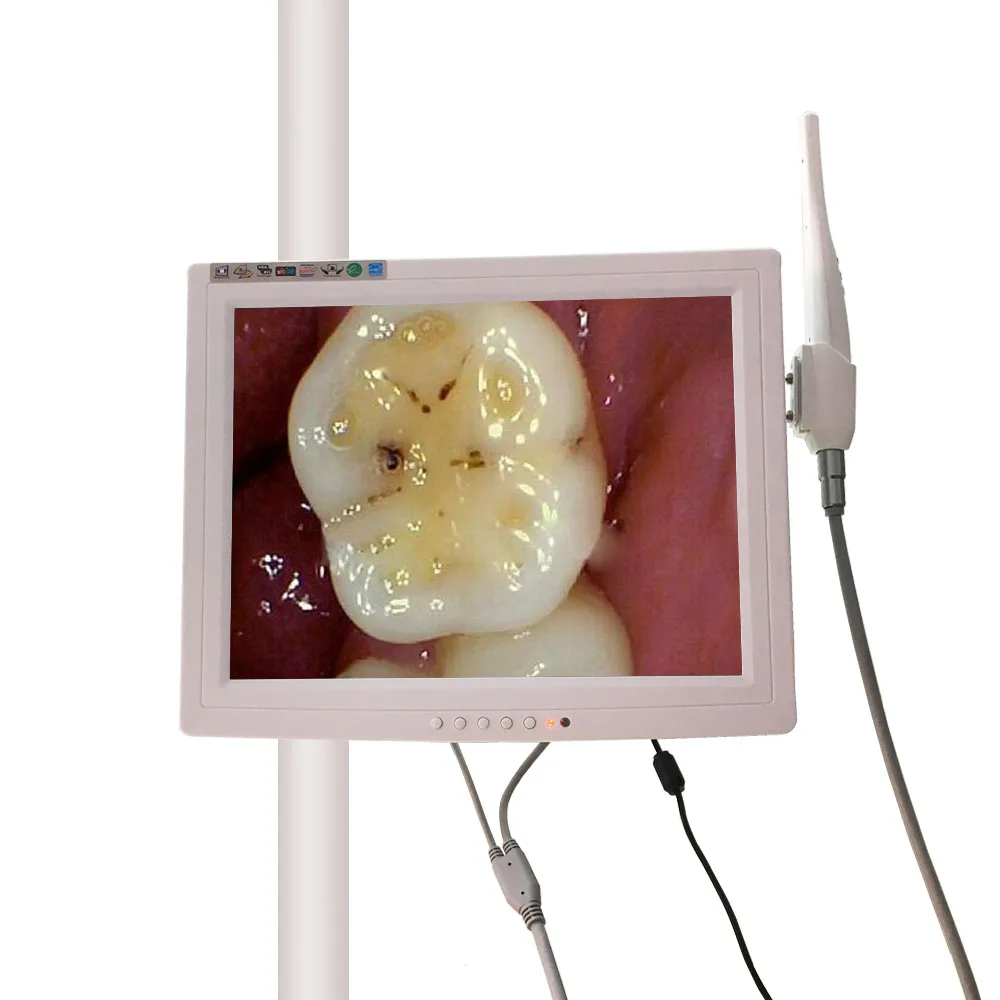 A0003 with a 15 inch monitor VGA Intraoral Camera Endoscope Borescope 6 ...