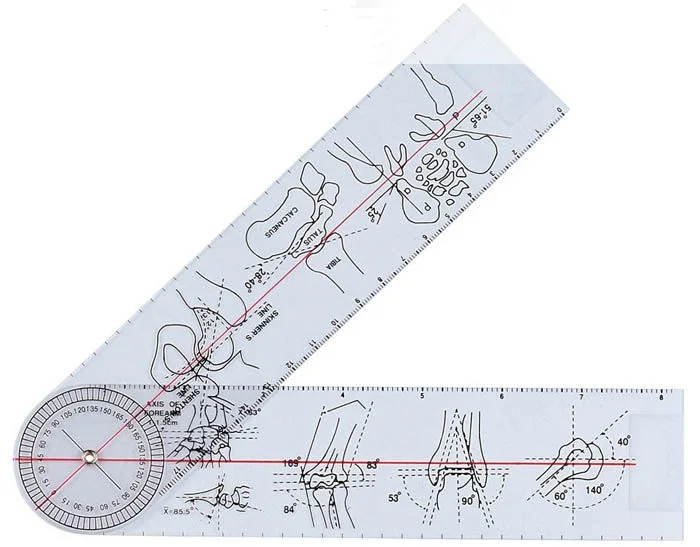 Orthopaedic Ruler Orthopedic Soft Foot Orthopedic Medical Transparent ...