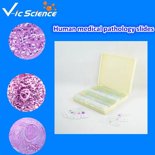100pcs Human Medical Pathology Slides - Educational Equipment - AliExpress