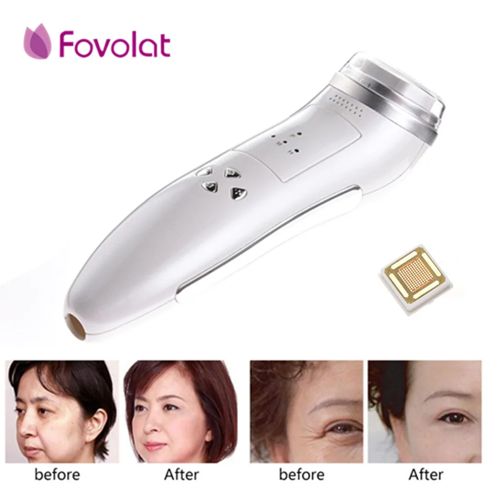 Beauty Care RF Radio Frequency Thermage Machine For Lifting Face, Lift ...