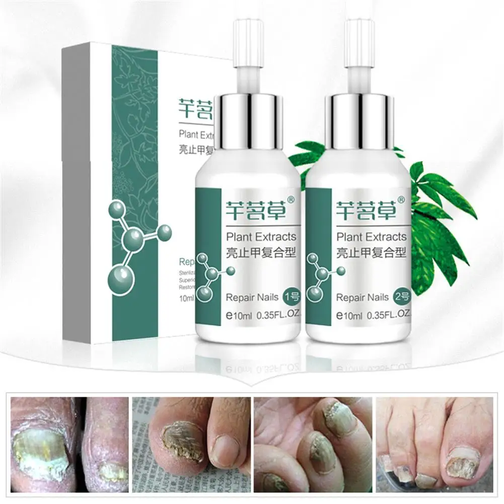 Эффективно против грибка ногтей против грибкового раствора ногтей на ...