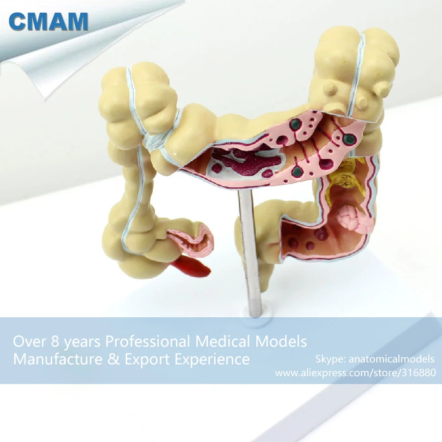 12533 / CMAM INTESTINE01 Colon Model Large Intestines Anatomy Model on ...