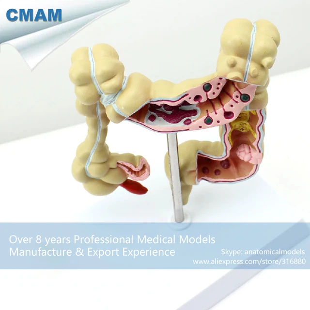 12533 / CMAM INTESTINE01 Colon Model Large Intestines Anatomy Model on ...