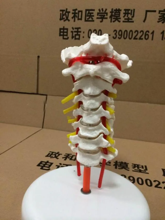 Modelo de columna Cervical con sistema nervioso, sistema médico de ...