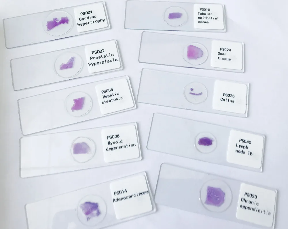 200pcs Human Pathology prepared slides - AliExpress