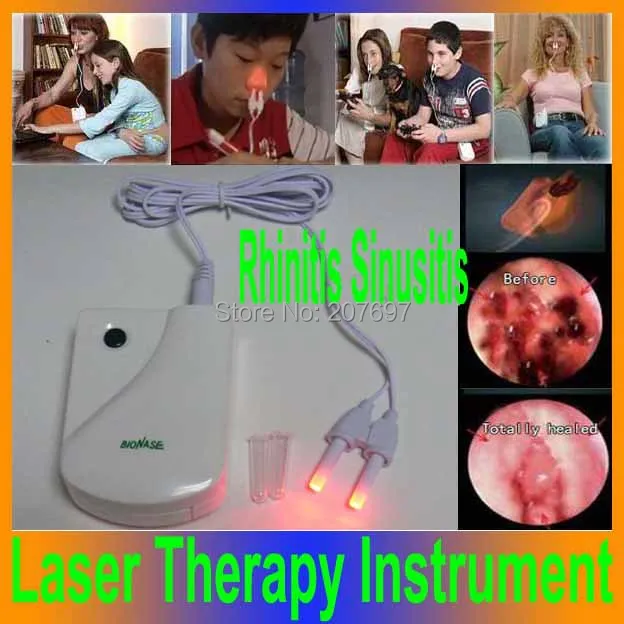 מכשיר אפילציה - Epilator BioNase Nose Rhinitis Sinusitis Therapy laser ...