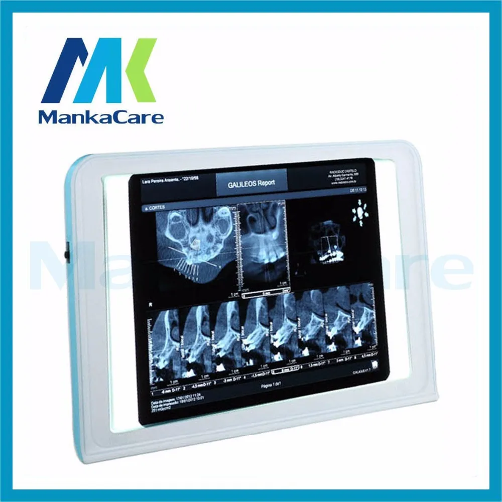 Negatoscope one bank/Led film viewer/X ray film viewer Dental X Ray ...