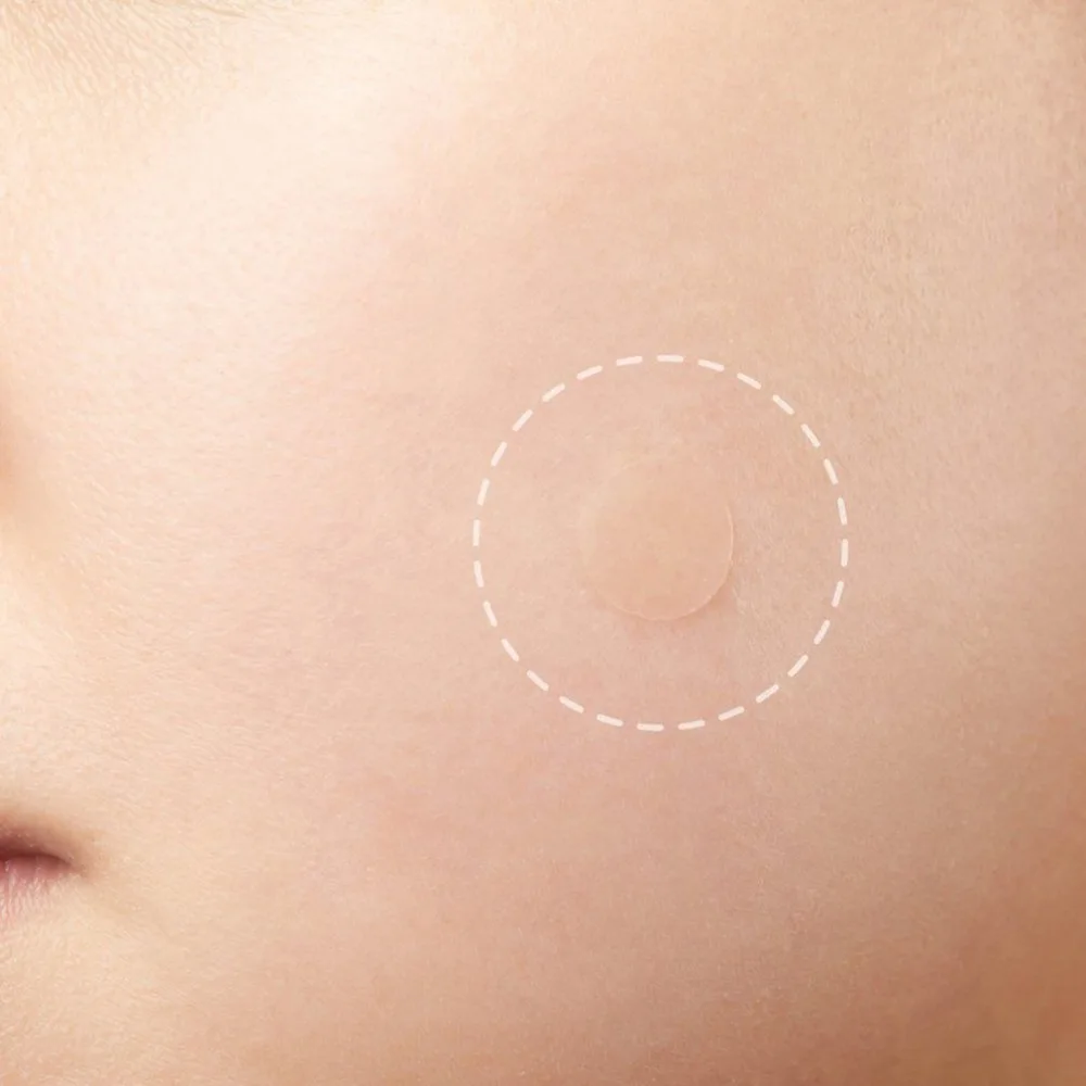 Acne Pimple Master Patch 24 Patches Korean Cosmetics Makeup 7mm 10mm Acne Pimple Master Patch 24 Patches Korean Cosmetics Makeup 7mm 10mm