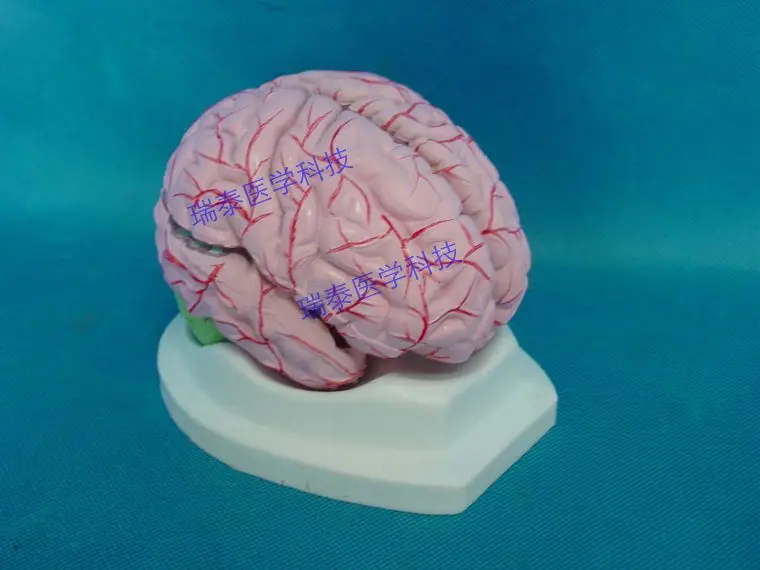 1:1Brain tissue model with Blood vessel Anatomy of the brain|blood ...