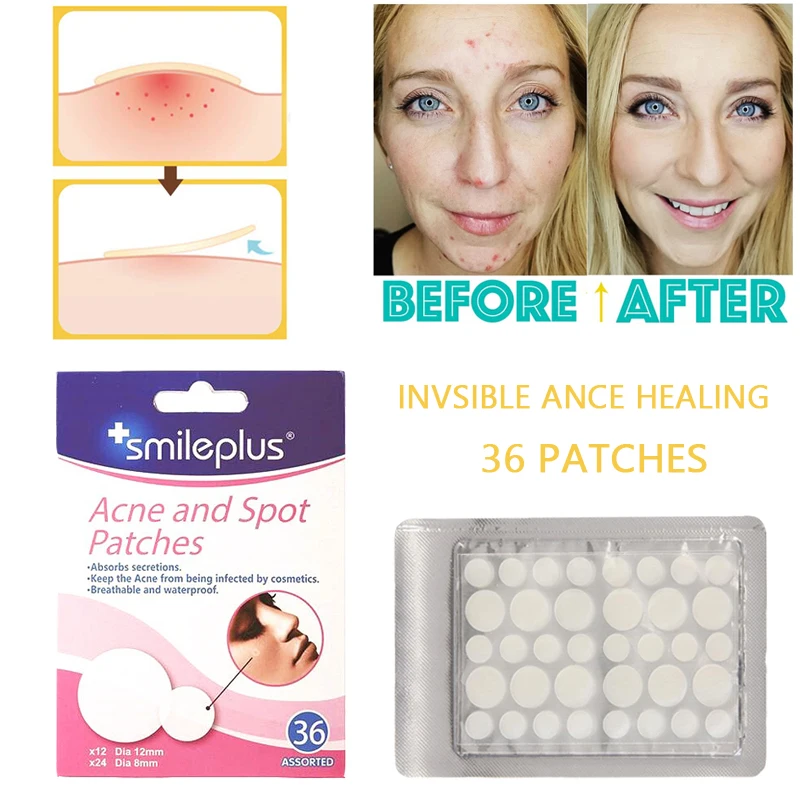 Aliexpress.com : Buy Hydrocolloid Acne Pimple Master Patch 36 counut ...