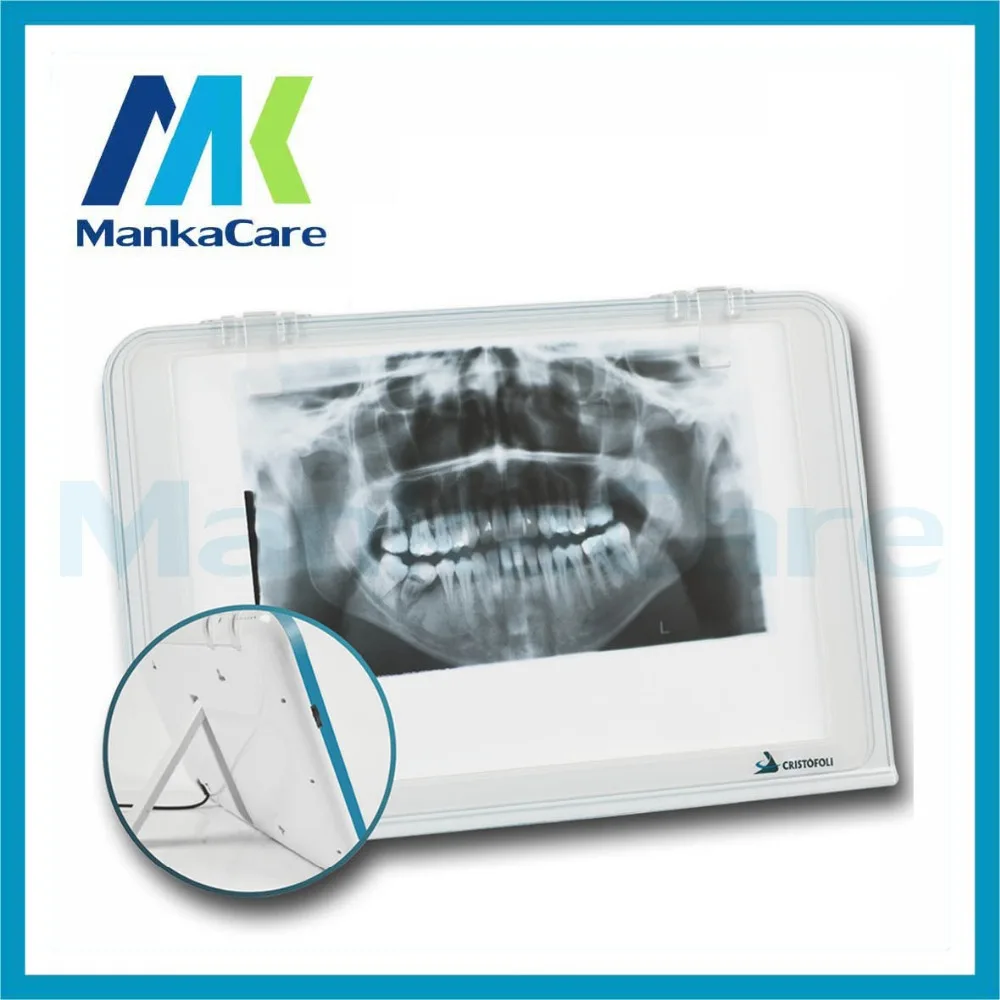 Dental X ray film Illuminator Viewer Light Panel Screen/Led film viewer ... Dental X ray film Illuminator Viewer Light Panel Screen/Led film viewer ...