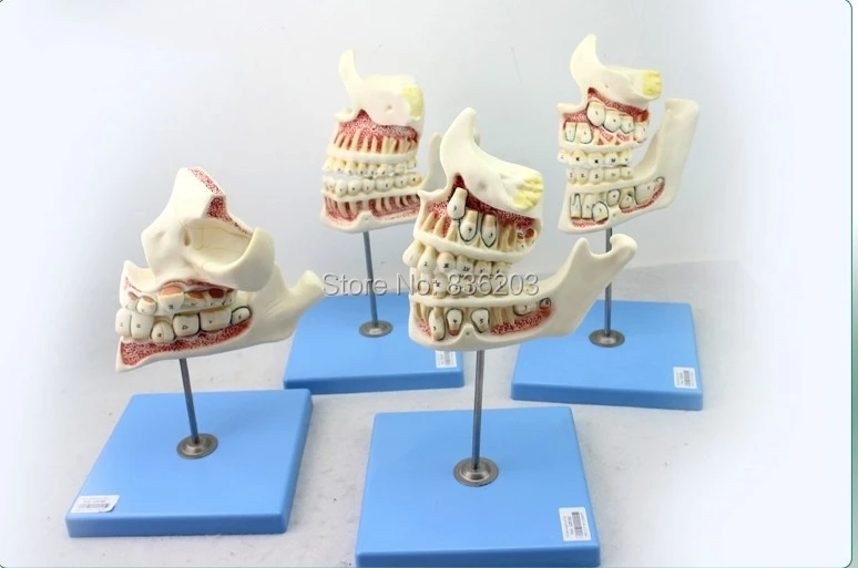 Human child Development of Teeth and jaw anatomy Dentition Development ...