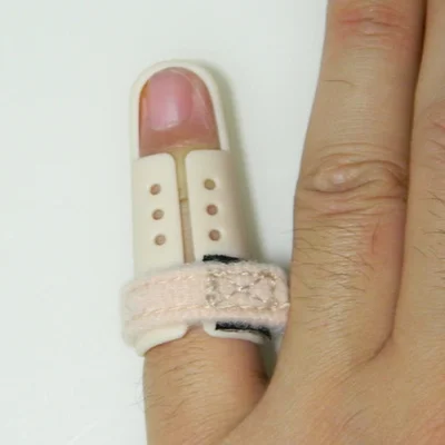 Retaining finger protection Extensor tendon fracture Phalangeal ...