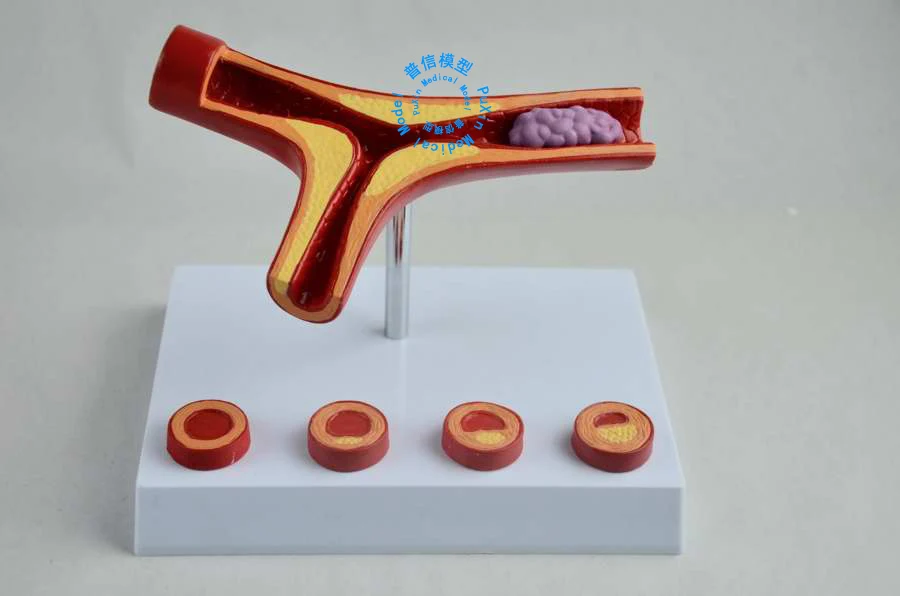 Free-shipping-Imported-technology-arterial-stiffness-model-with ...