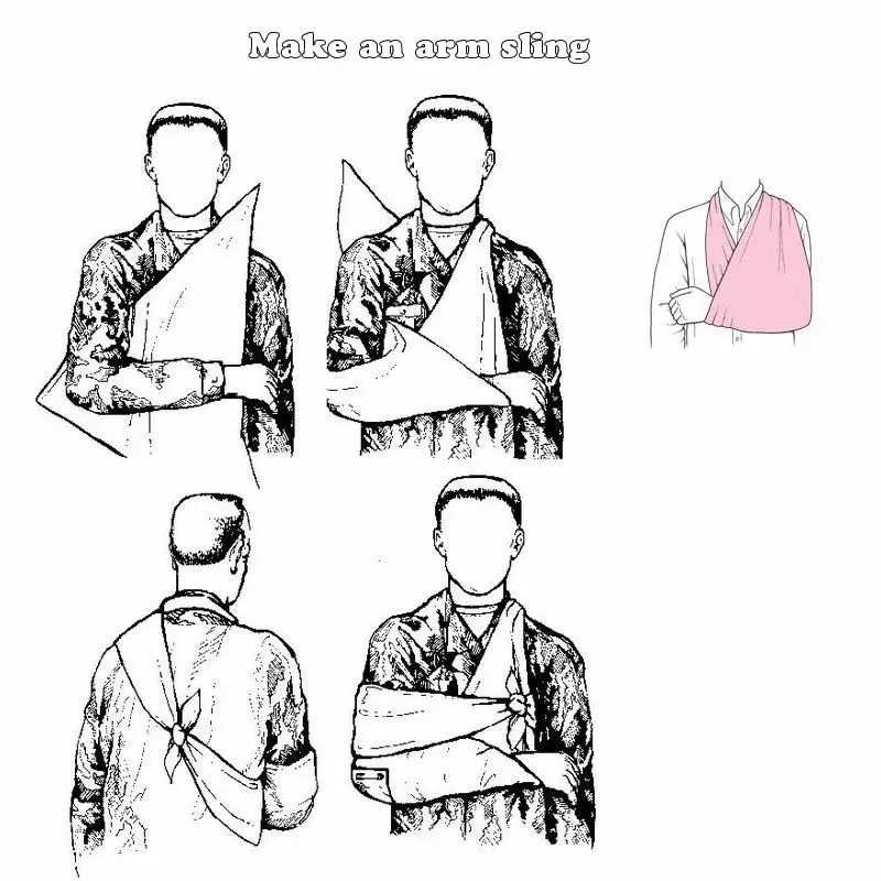 Triangular Bandages (sling)