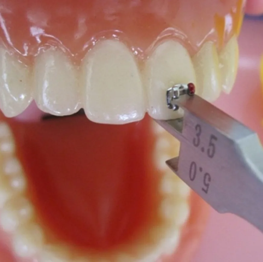 3pcs Dental Bracket locator Bracket Gauge Dental|orthodontic instrument ...