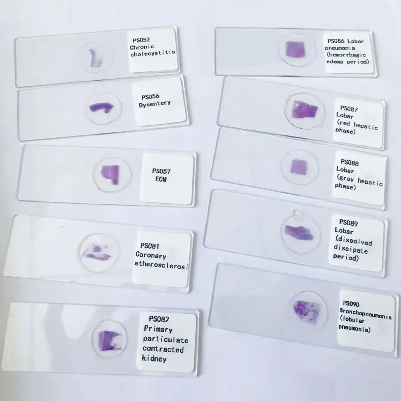 200pcs Human Pathology prepared slides - AliExpress