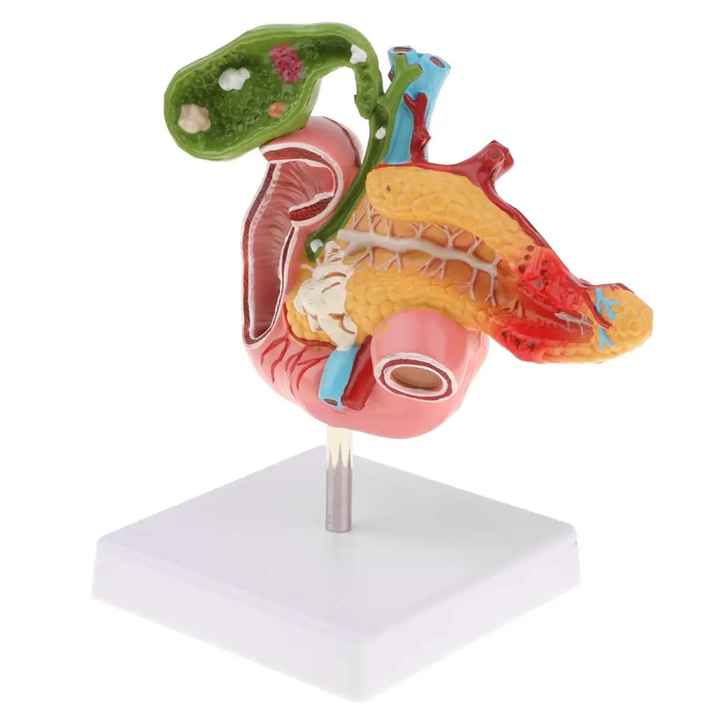 1: 1 Gallbladder Duodenum Pancreas Model Human Organ Anatomical Model ...
