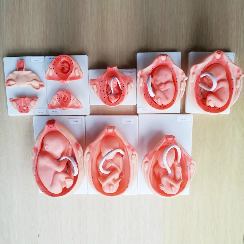 10 pcs Pregnancy development process model Embryonic uterus Fetus model ...