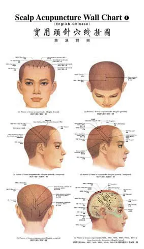 Scalp-Acupuncture-Wall-Chart-Multi-Language-Optional-English-Spanish ...