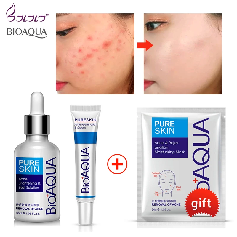 BIOAQUA Acne Treatment Set anti acne treatment cream oil control ...