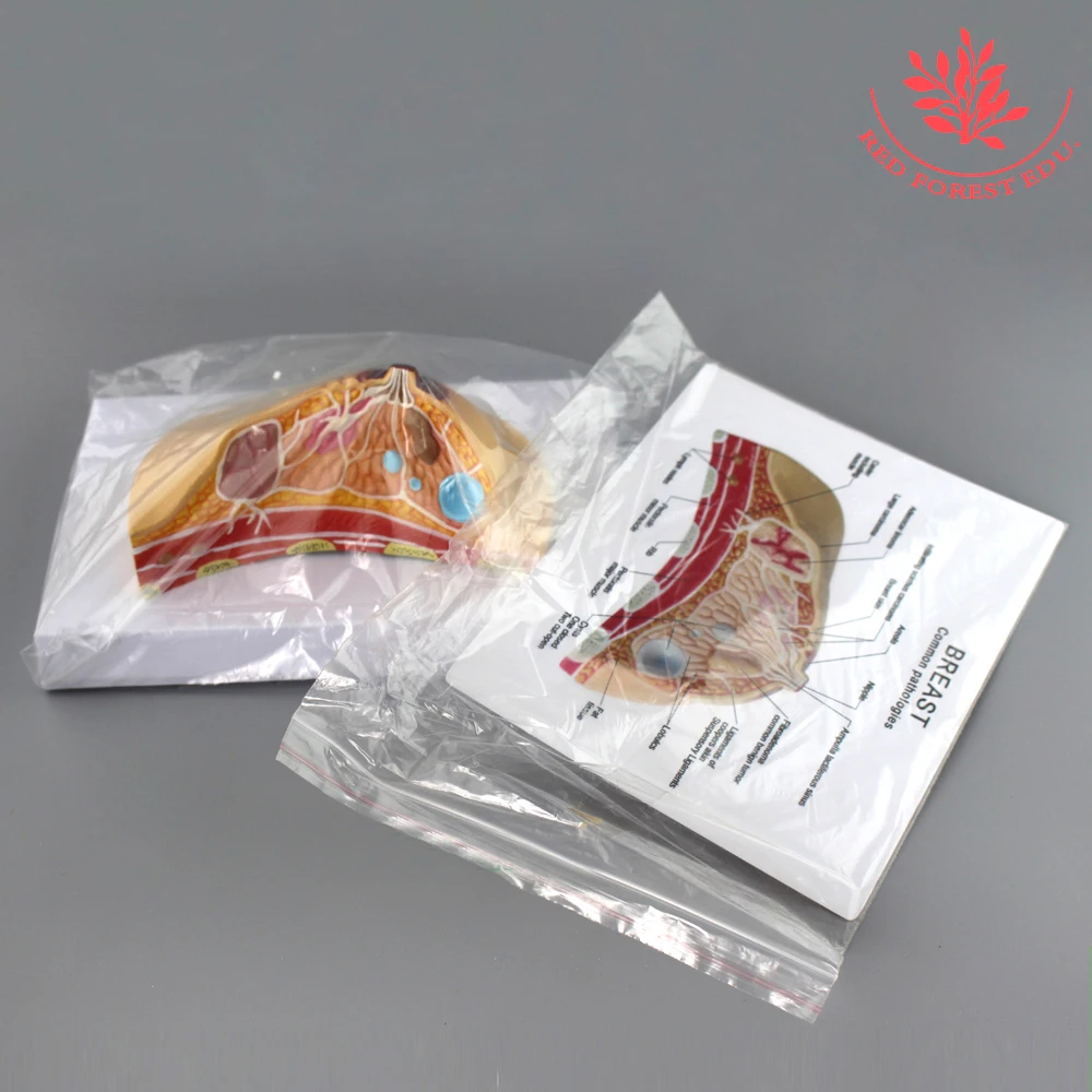 Anatomical teaching breast cancer pathology model|breast modeling ...