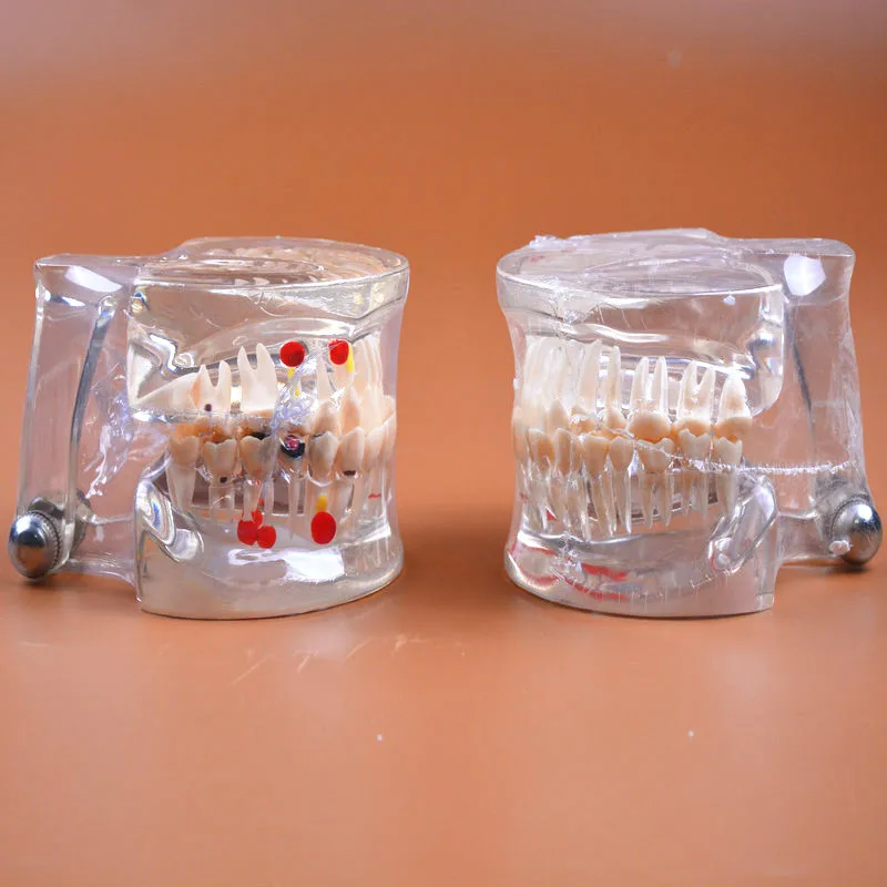 2pcs/lot Dental pathology model dentistry oral care teeth models ...
