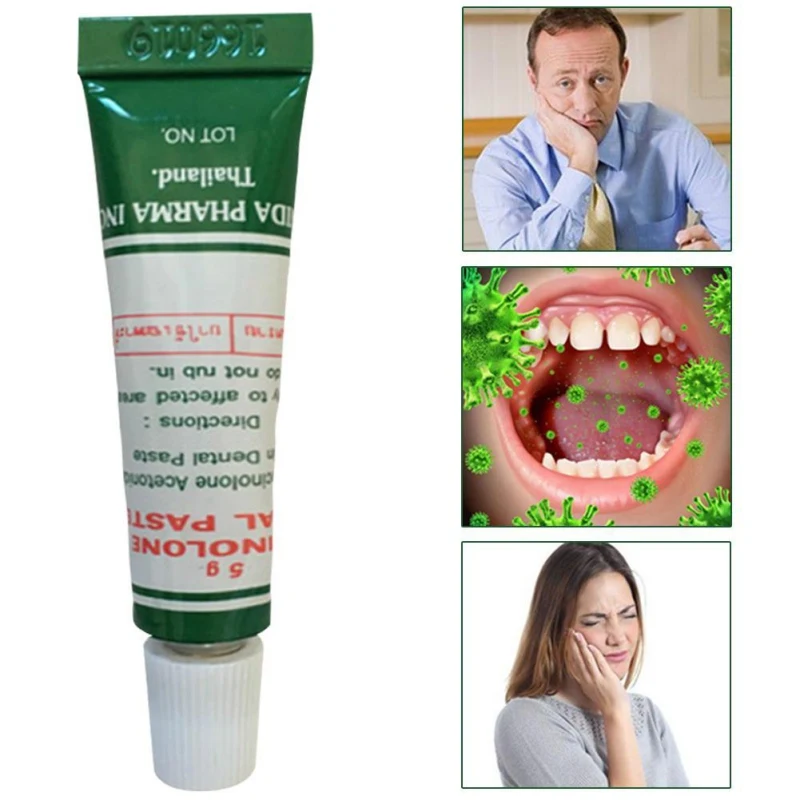 2019 New Practical Oral Ulcer Cream Effective Anti-inflammatory Relief ...