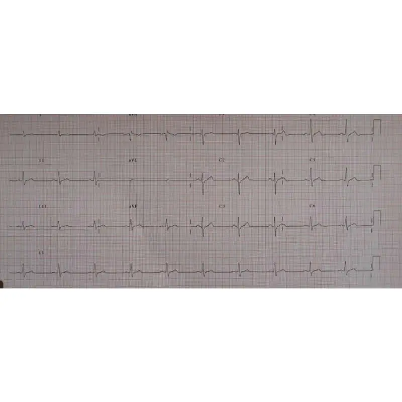 Medical vital signs simulator SKX-2000C ECG signal generator simulator ...