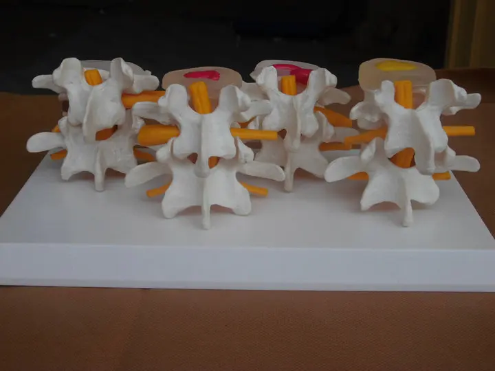 Human-skeleton-model-lumbar-disc-disease-model-spine-model-lumbar-bone ...