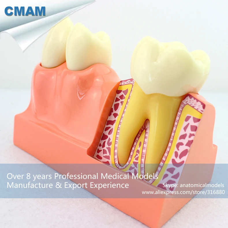 Aliexpress.com : Buy 12599 CMAM TOOTH21 Oversize 4 Times Permanent ...