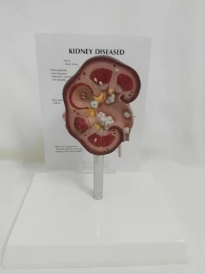 Renal-anatomy-teaching-aids-Model-of-medical-instrument-Renal ...