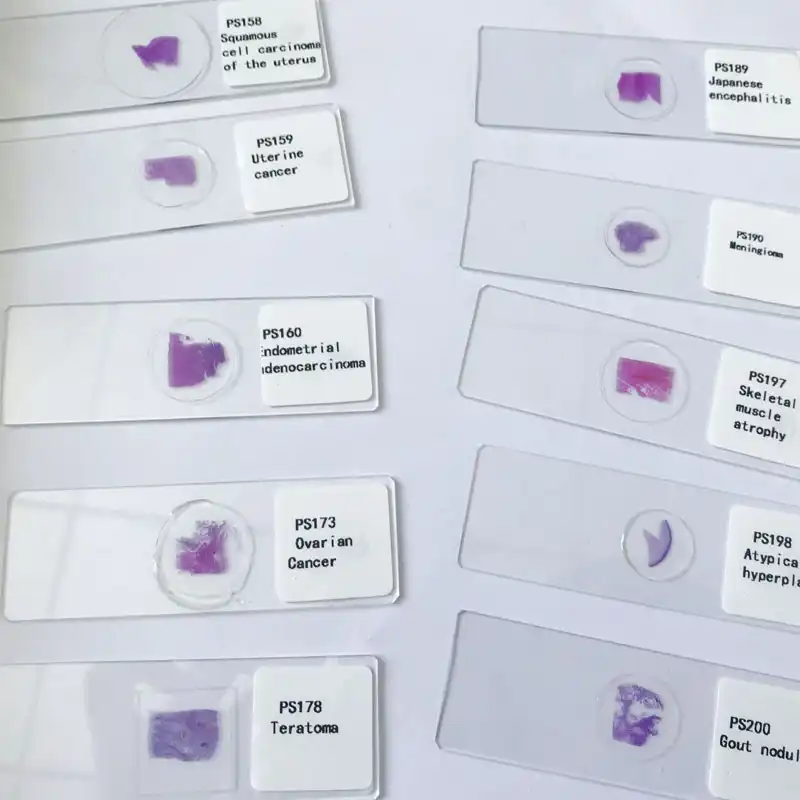 200pcs Human Pathology prepared slides - AliExpress