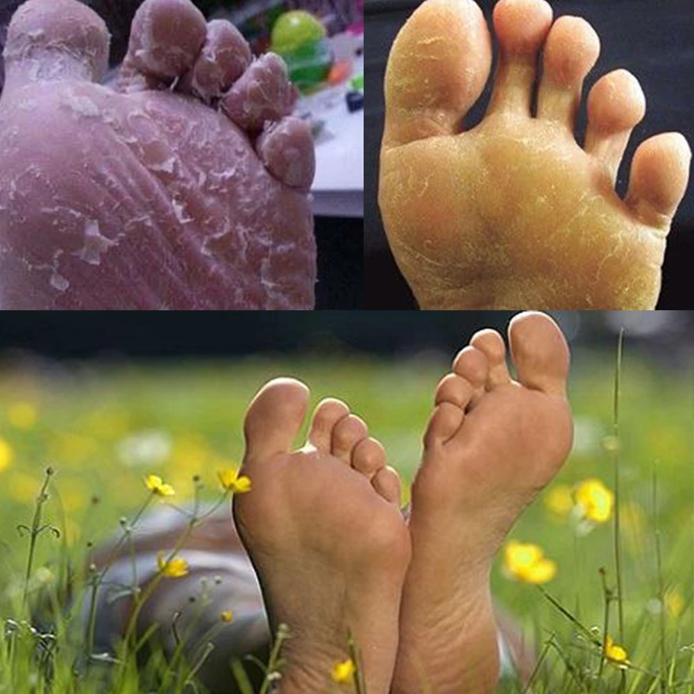 Anti-Swelling Foot Spa Soaking Feet Massage Ginger Effervescent Tablets ...