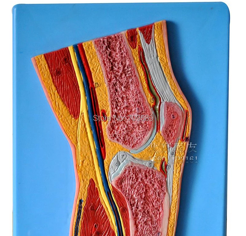 ISO Knee Joint Section Model, Anatomical Knee Model - buy at the price ...