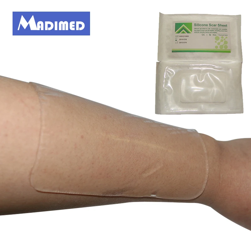 MADIMED Macure 7.5CM*4.5CM Silicone Gel Scar Therapy Patch Scar Away 1 ...