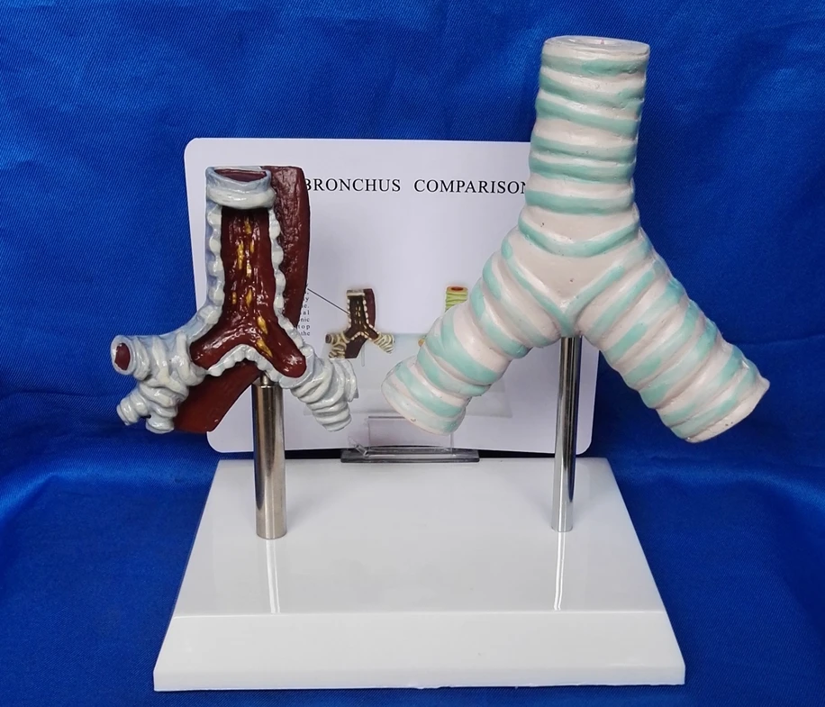 Life Size Human Pathological Bronchus Anatomy Model Comparison Smoking ...