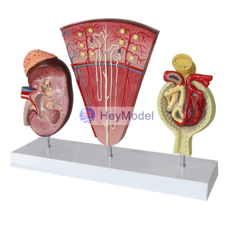 HeyModel Cecum and appendix model ileum model Lymphatic and ...