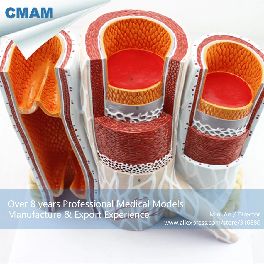 12492 CMAM HEART16 Model Of Vascular Anatomy Amplification In Human ...