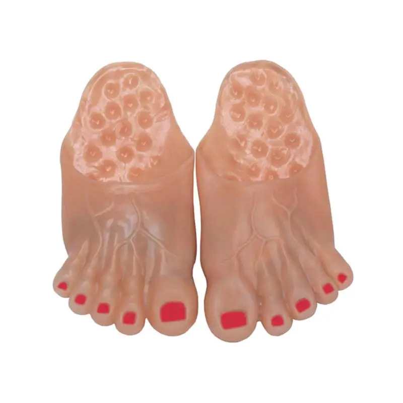 X Rays Of Broken Feet Rome