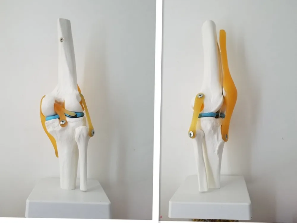 Medical Life Size Human Body Anatomical Knee Joint Ligament Model ...