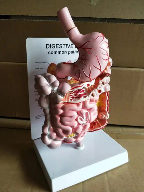 Human-gastrointestinal-pathology-model-doctor-patient-communication ...