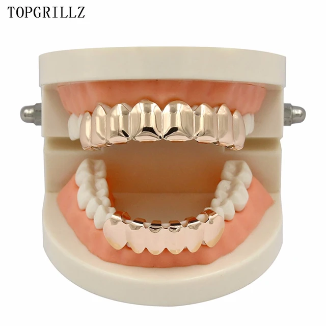 Rose Gold Teeth