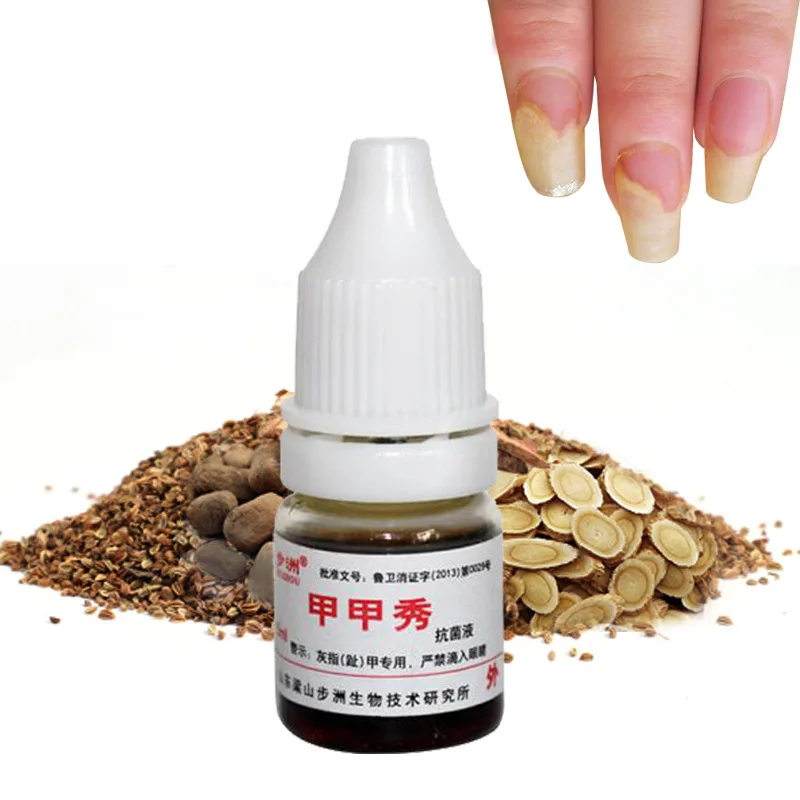 Lanthome 5ml Anti Infection Nail Fungus Treatment / Onychomycosis ...