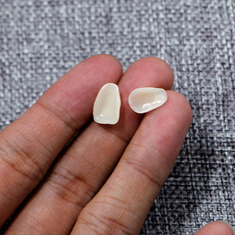 50pcs Dental Temporary Crown Resin Porcelain Materials Anterior Teeth ...