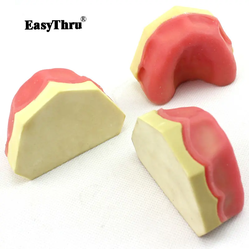 Human Body Simulated Oral Implant Model Mandibular Attached Gingival ...