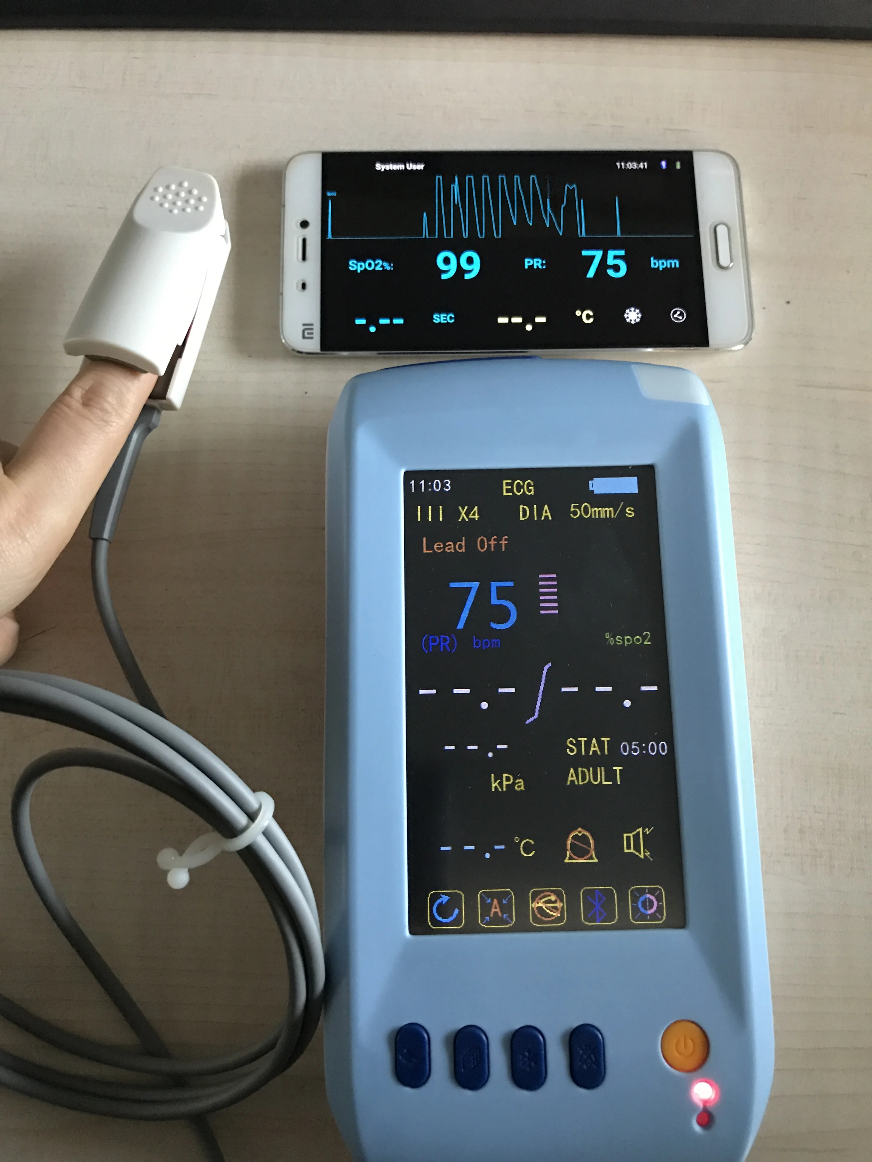 Handheld bluetooth touch screen vital Sign patient monitor with SPO2 ...